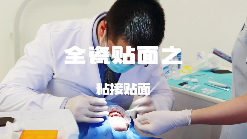 全瓷贴面究竟是怎么粘接在牙齿上的?