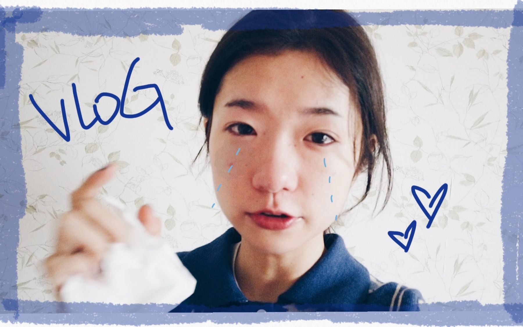 重见光明!近视眼激光手术全过程分享(全飞秒)