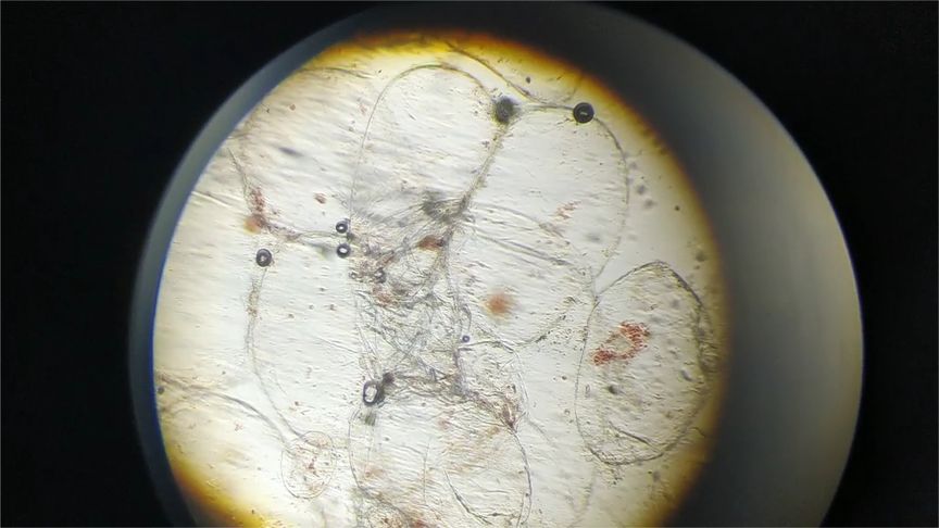 孩子自己动手制作并用显微镜观察——番茄果肉细胞