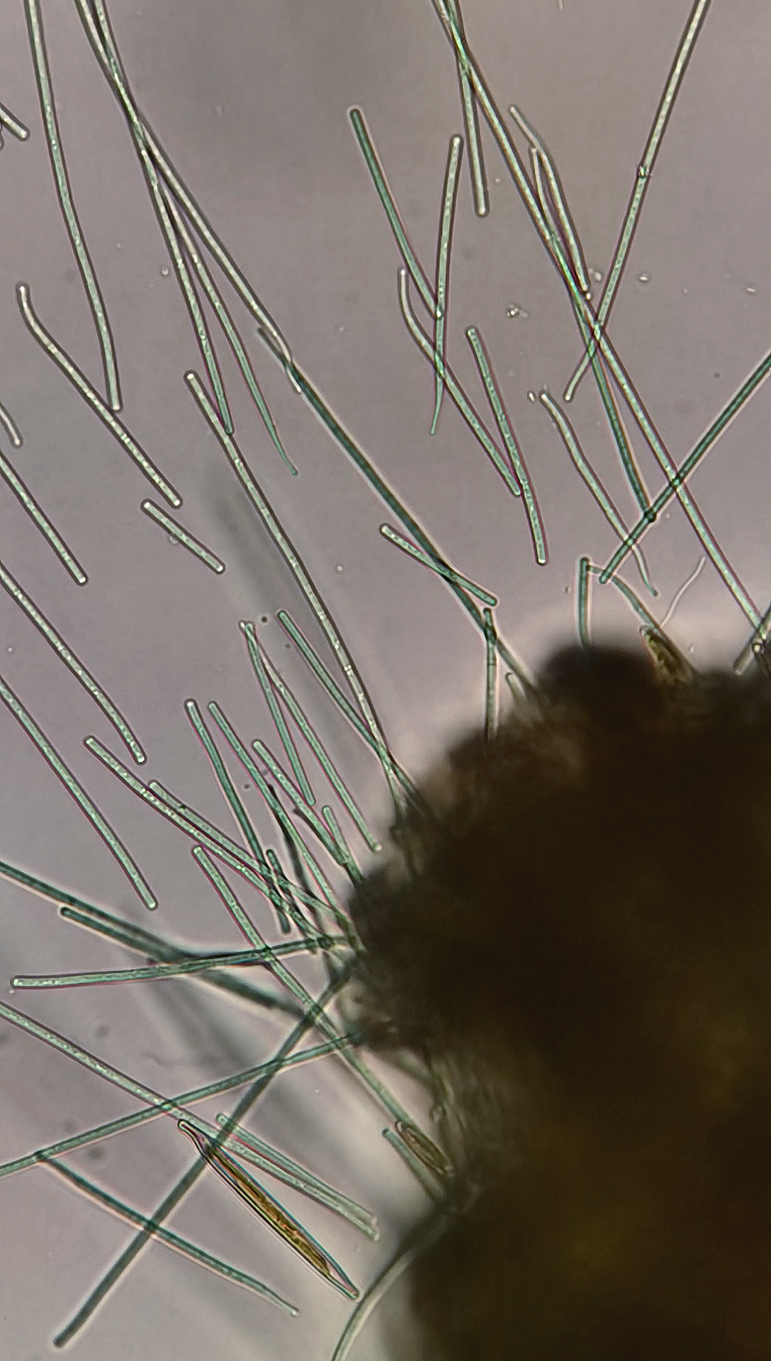 显微镜日常001~浮游泽丝藻群落