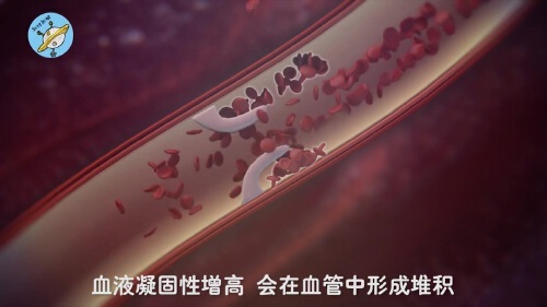 血栓是怎样被切除的?3D动画下展示全过程,场面太壮观了