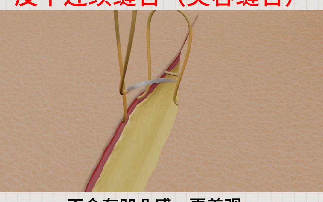 皮下连续缝合(美容缝合),动物皮肤缝合之美容缝合3D视频演示