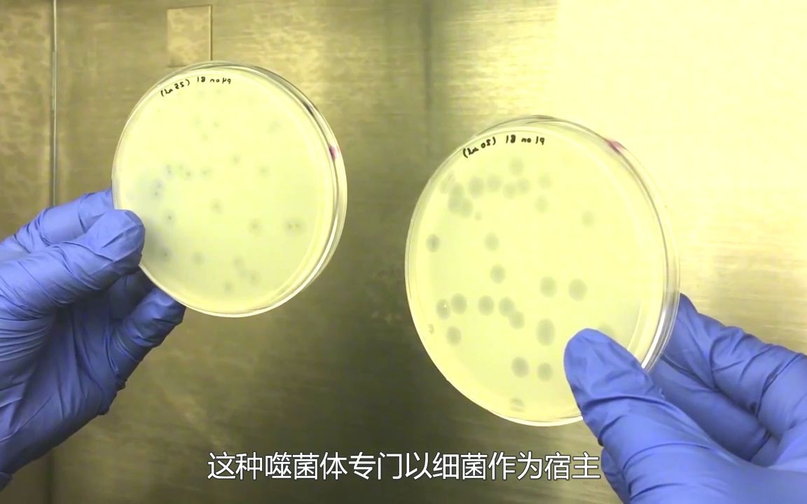 噬菌体是什么?造型科幻就像机器人,细菌的克星