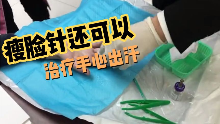 肉毒素注射治疗手部多汗症