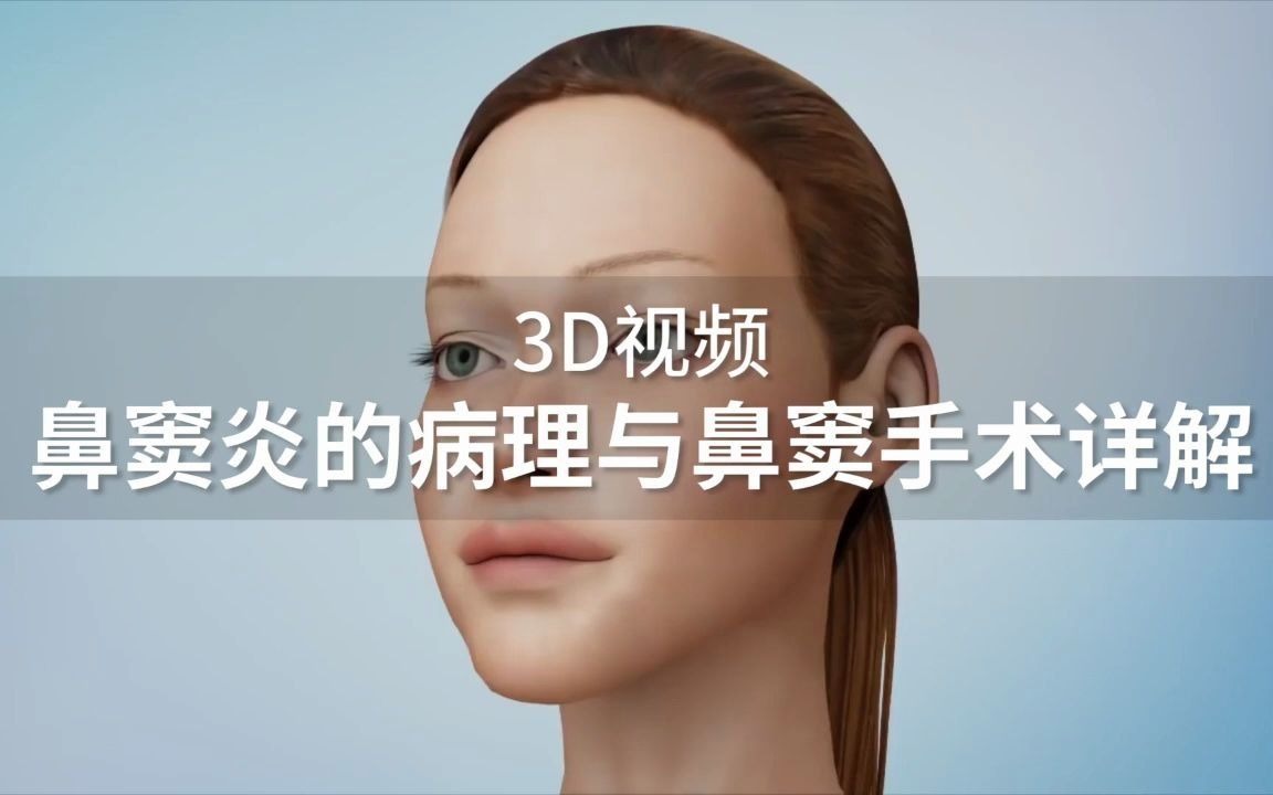 3D动画:鼻窦炎病理和手术过程演示详解