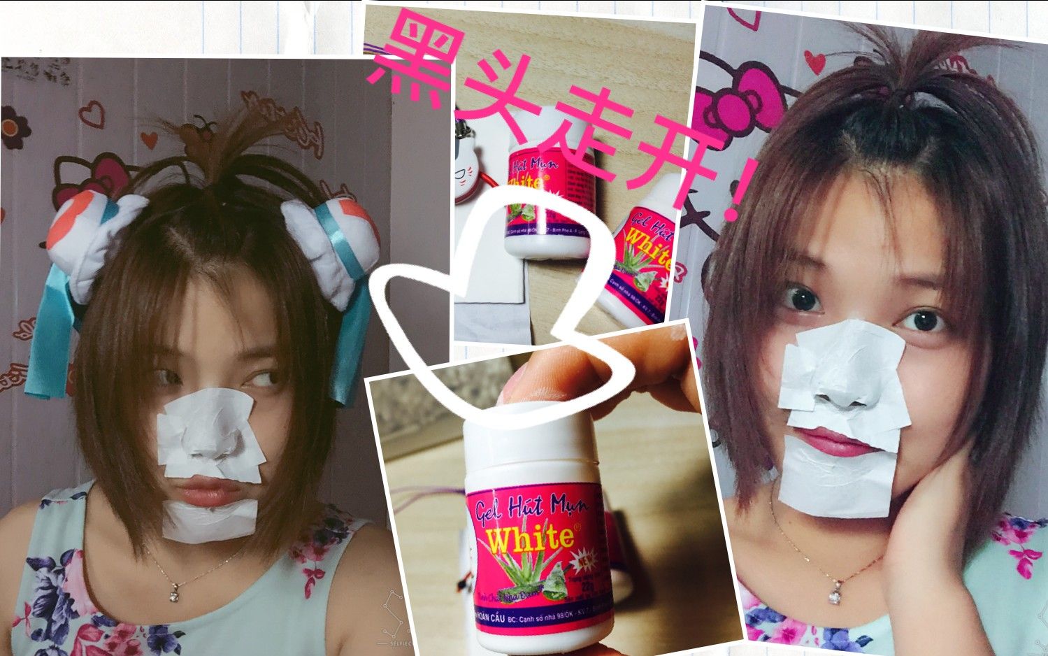 【san胖】泰国芦荟胶鼻贴使用——黑头走开!