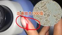 新鲜的血液放大1000倍竟然是这个样子, 终于看到了红细胞和白细胞