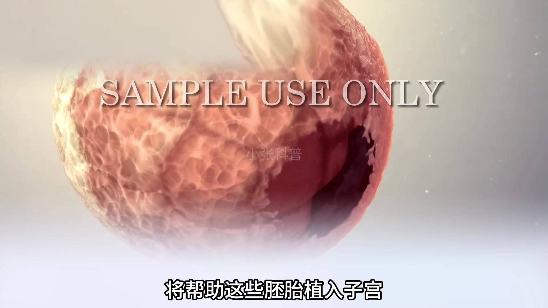 带你了解体外受精的全过程#试管婴儿