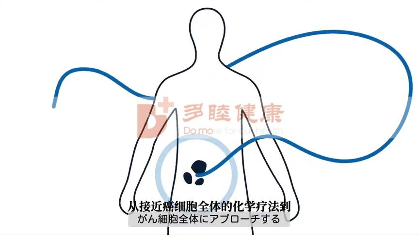 多睦健康:挑战癌症治疗-CAR-T细胞疗法