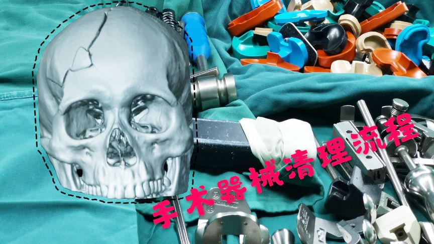 手术后下台的医疗器械是什么清洗流程?网友:为医疗工作严谨点赞