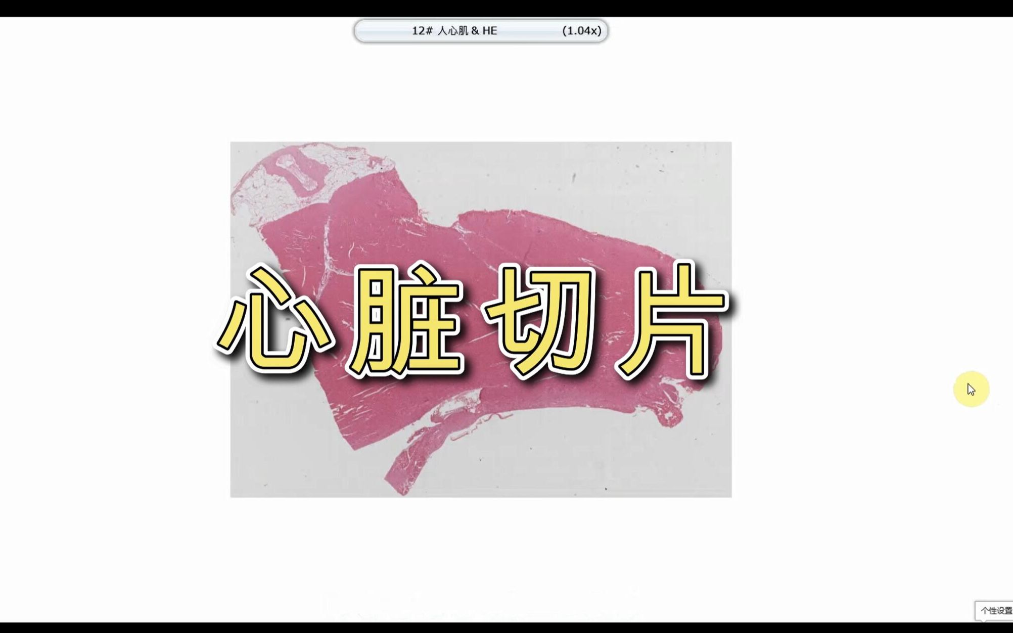 循环系统-心脏-组织切片解读