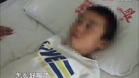 生物细胞三联修复疗法治疗肌营养不良康复案例