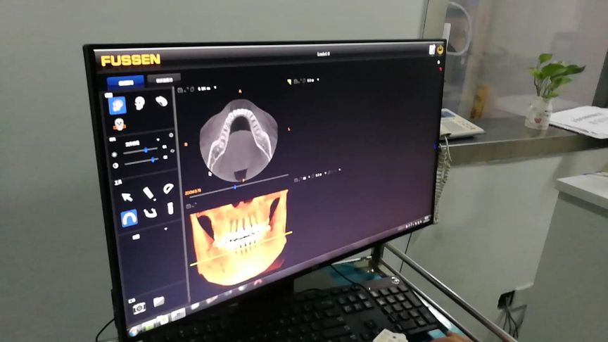 颌面部CT的软件的使用方法1