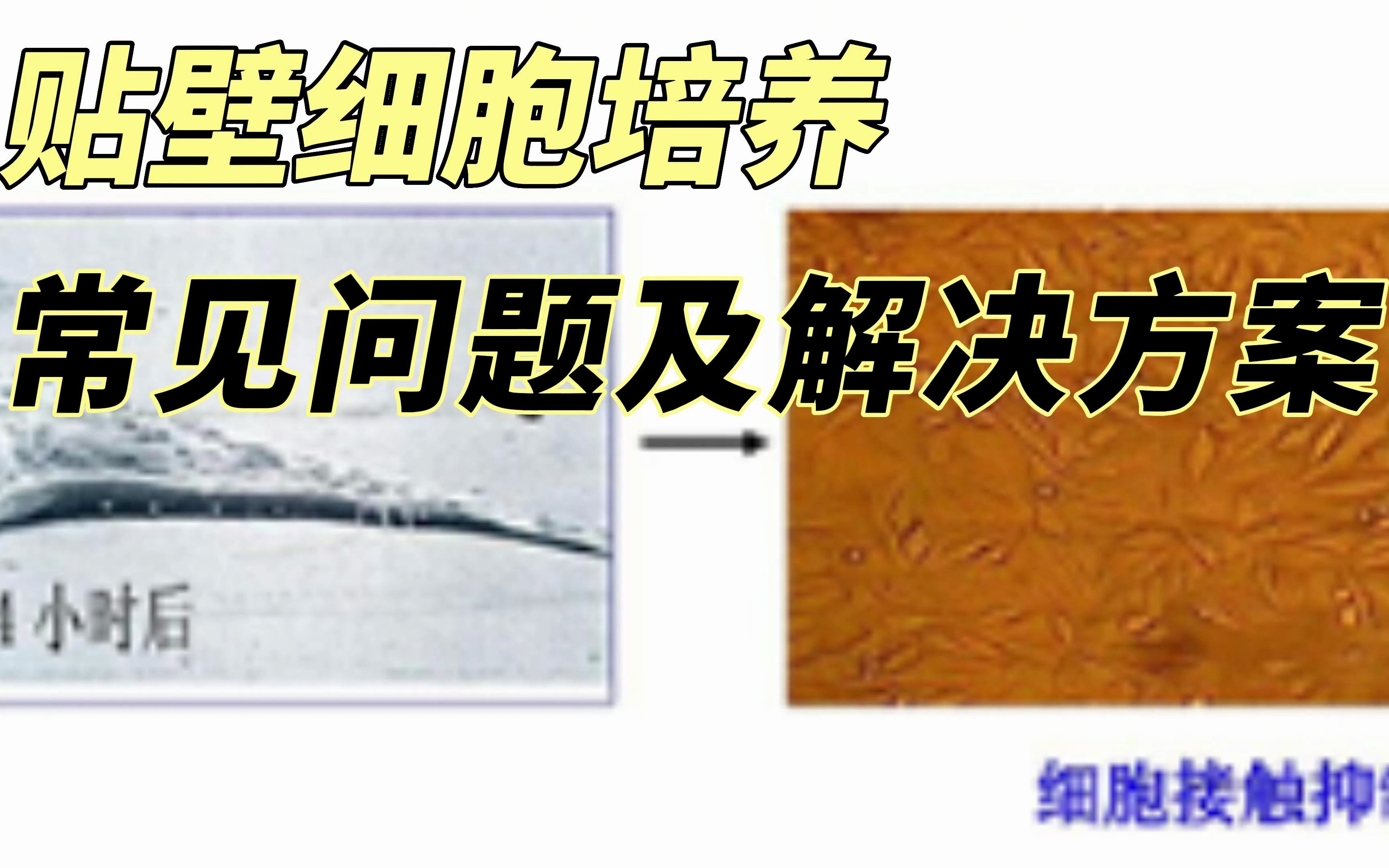 实验室新手手册 | 贴壁细胞培养的常见问题及解决方案