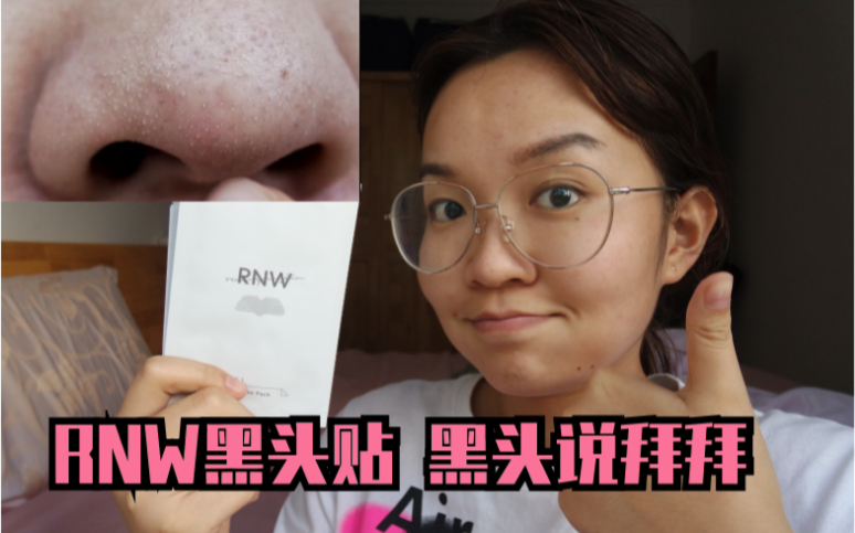 黑头预警!黑头贴测评 RNW黑头贴无滤镜重口测评 温和有效去黑头|...