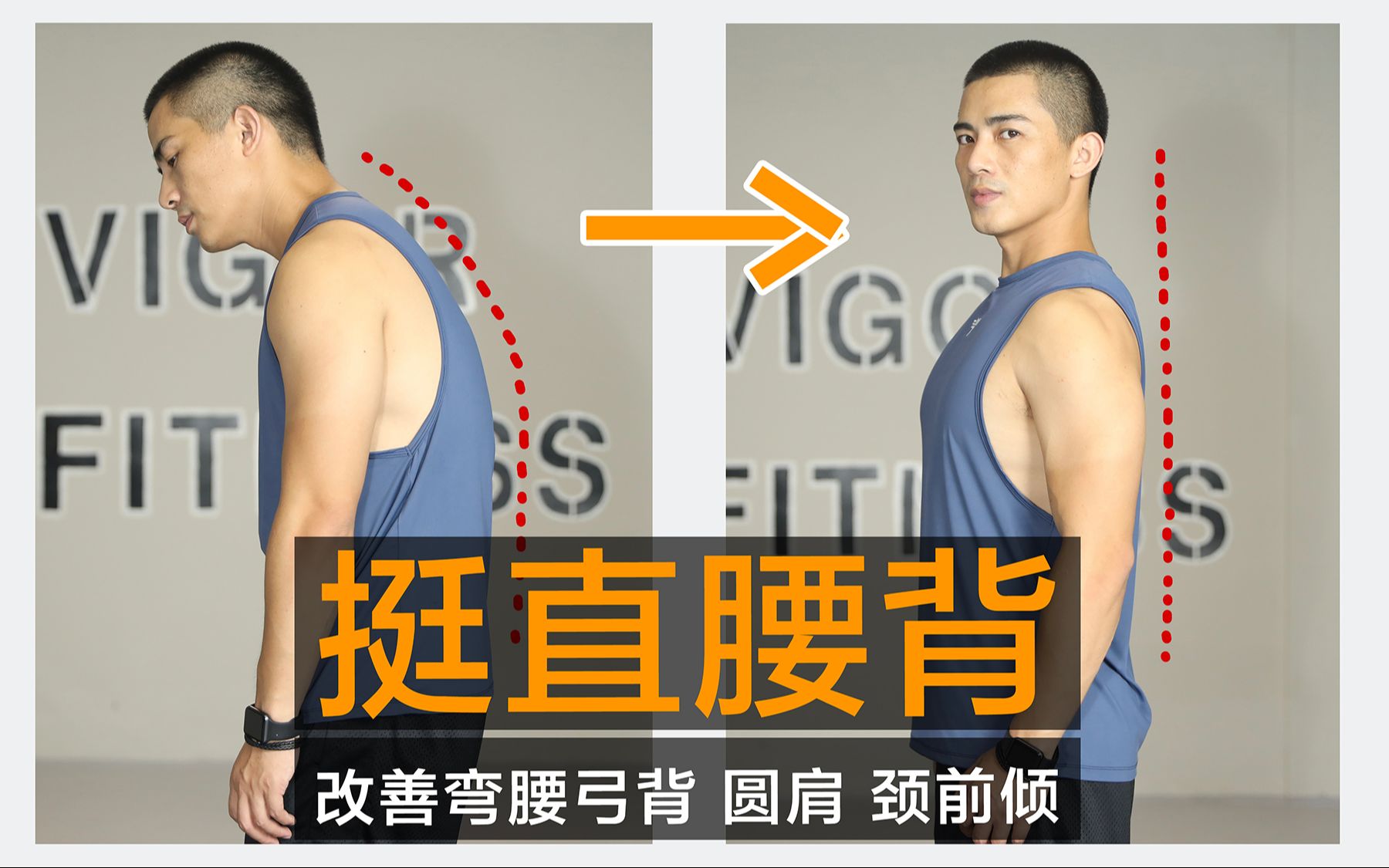 【改善体态】两种行之有效的方法,快速纠正弯腰弓背!