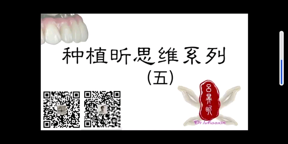5.种植体的颈部设计