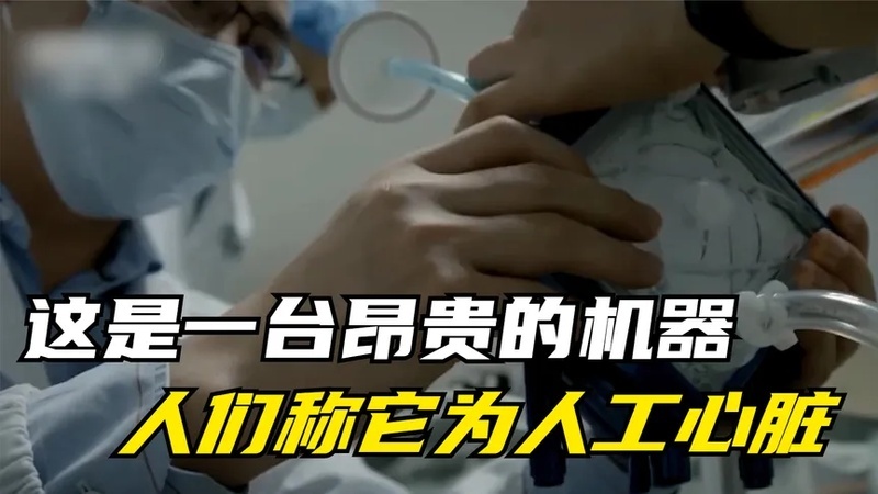 昂贵的医疗机器ECMO,也就是人们口中常说的人工心脏