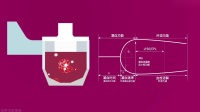 阳阳科普 + | 血栓弹力图图形形成分析