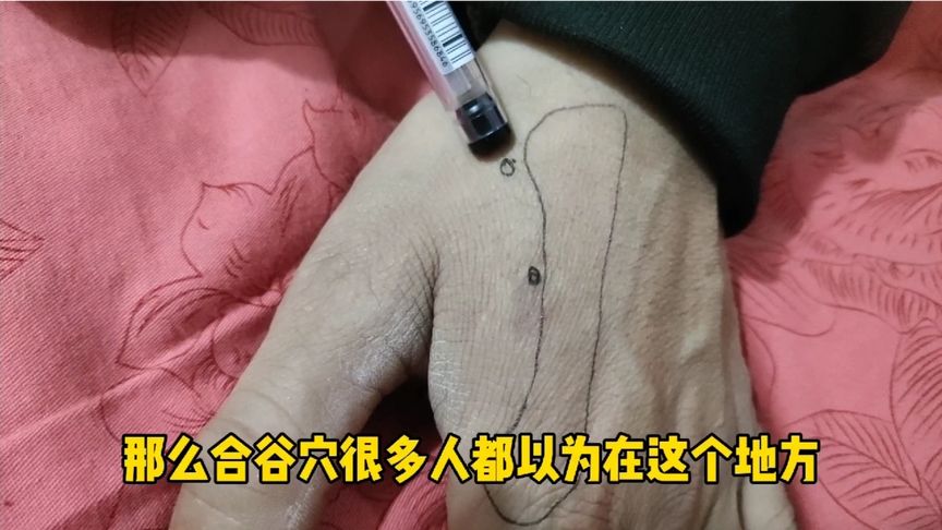 合谷穴正确位置以及艾灸方法