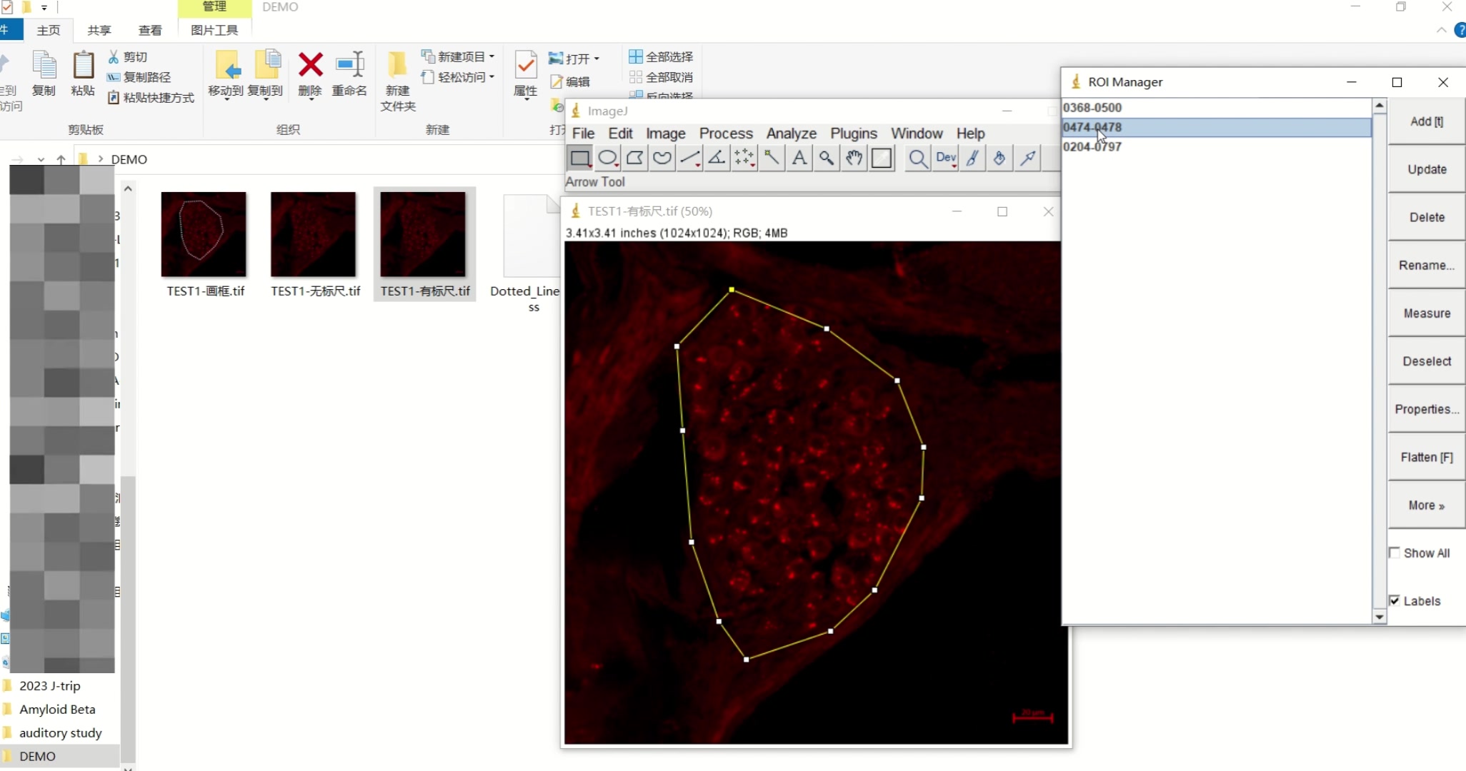 ImageJ-用虚线标注Rosenthal Canal范围并计算面积