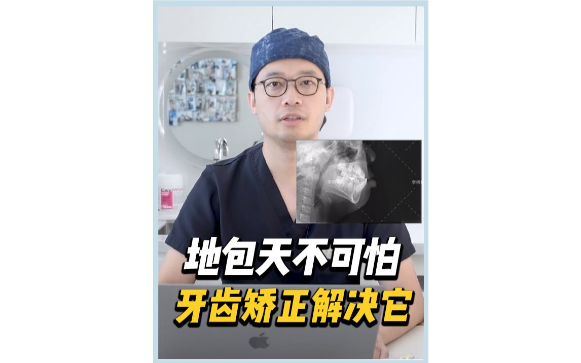 牙齿矫正改善地包天——矫正案例分析