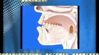 医用多能吸注套扎器教程