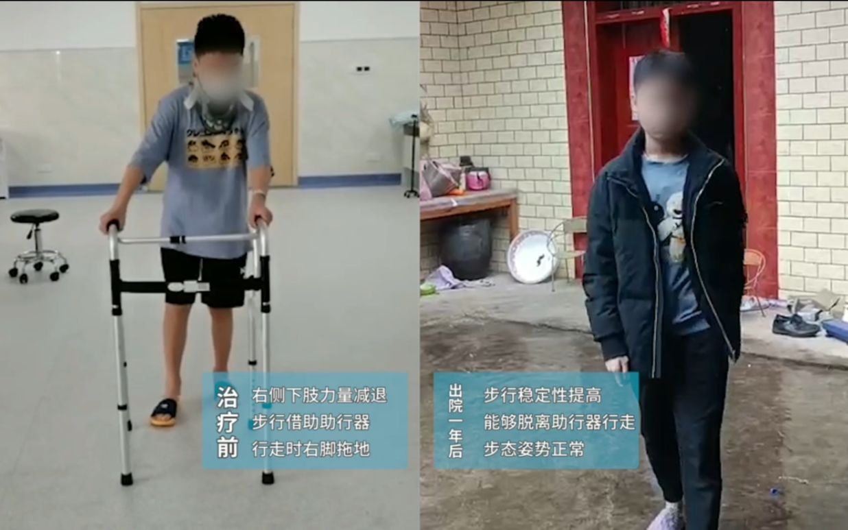 【案例纪实】脖子痛没在意,江西13岁孩子脊髓损伤!他在这里实现了从...