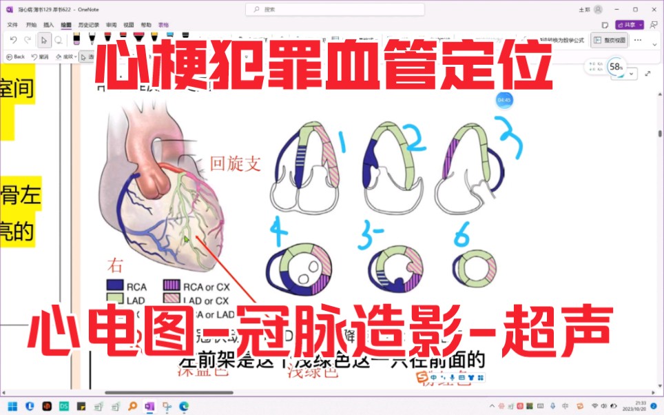 心梗犯罪血管定位入门/从考试的心电图到临床上的冠脉造影再到科研...