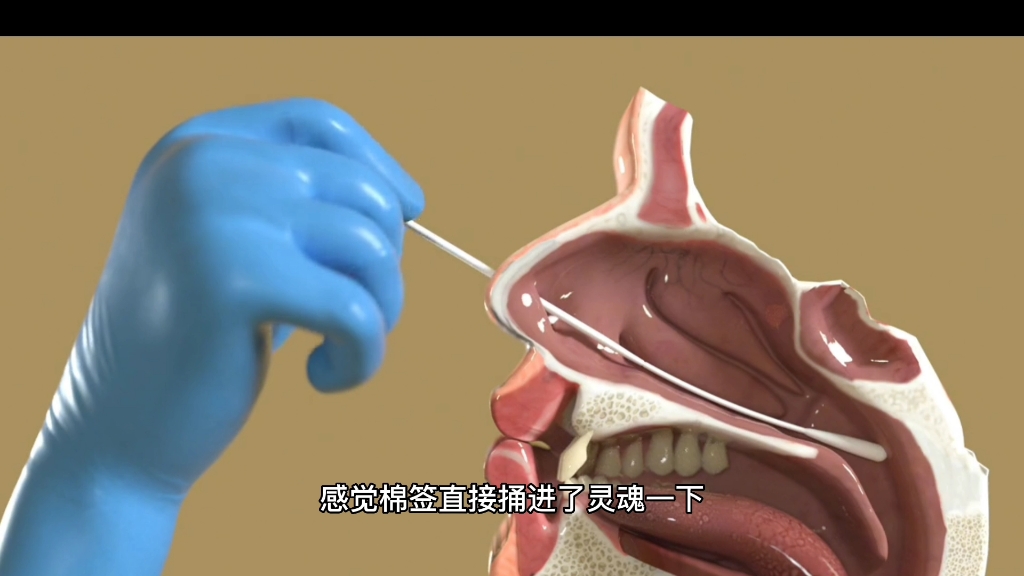 核酸检测,鼻咽囗咽拭子,具体什么位置你知道吗