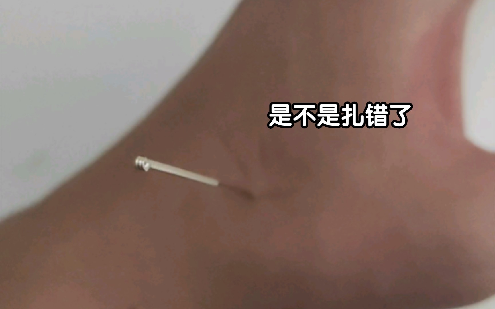 怎么判断针刺有没有扎中穴位,或者没扎中是啥感觉