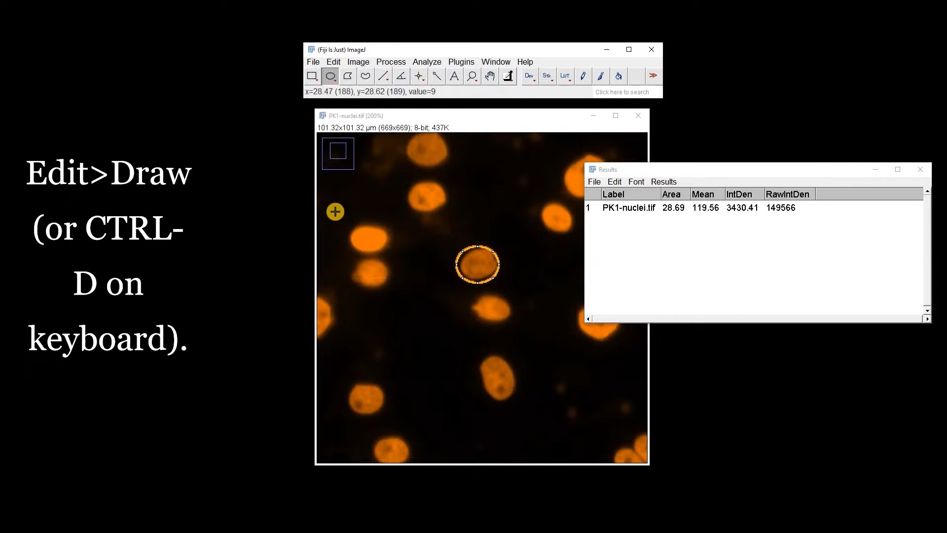 ImageJ ROI 和叠加功能