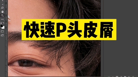 PS快速P头皮屑