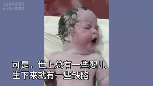 生命的挑战:宝宝面临染色体检查的故事