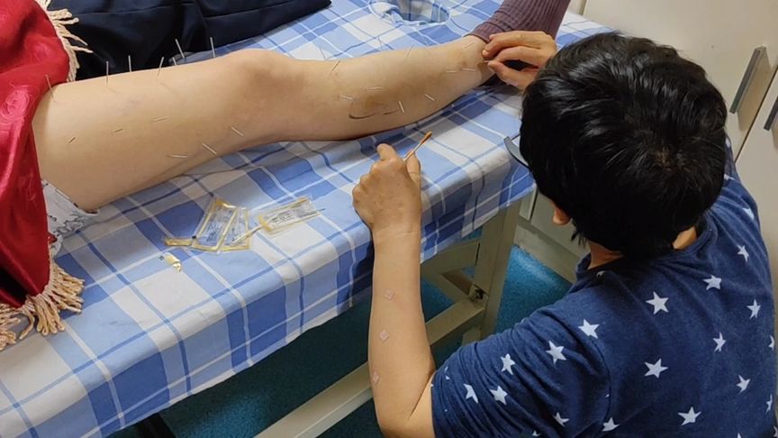 现场手把手教零基础学员扎针,这样学针灸,你才学的快学的好。