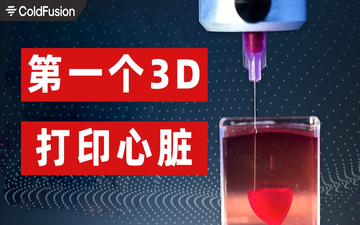 打印心脏来移植治疗,这谁想出来的?