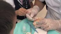 爱牙活动—幼儿体验补牙过程部分视频