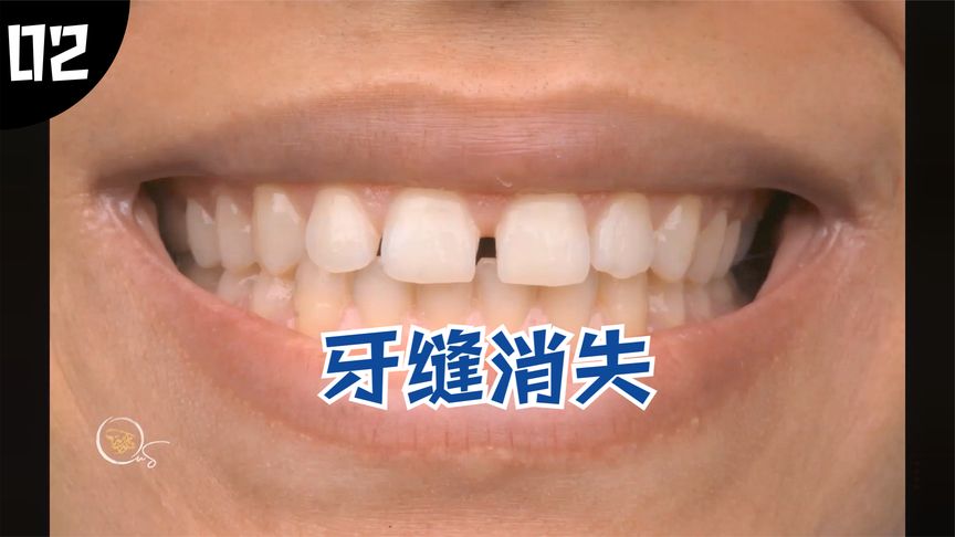 有一颗工匠精神的牙医做出的牙齿。