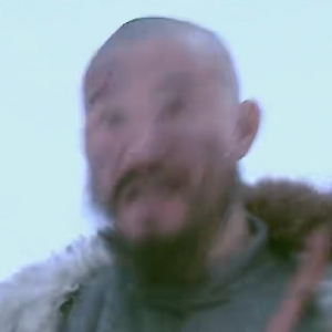 二得瓜让大车压死了 