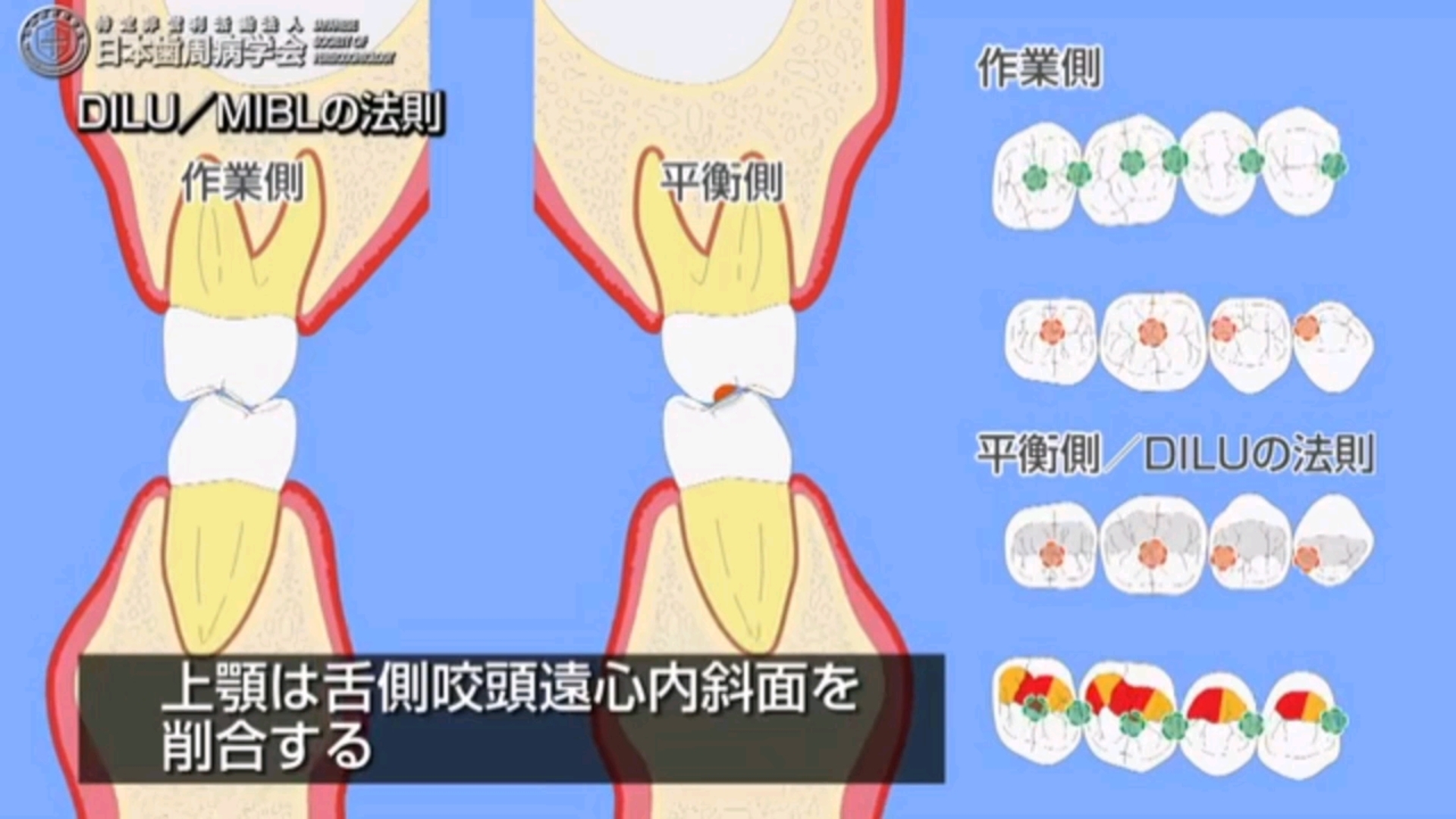 ଌ�学之咬合检查-平衡侧