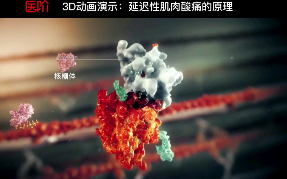 3D动画演示:延迟性肌肉酸痛的原理