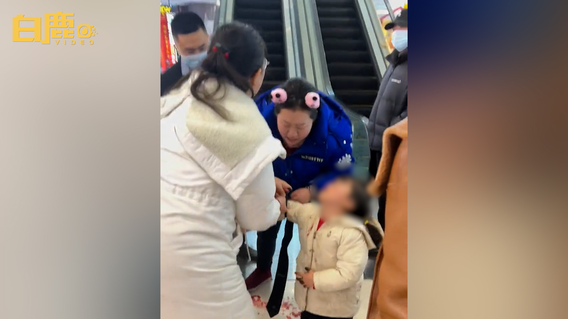 女童被扶梯夹流血众人用领带包扎救治