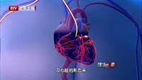心梗随时可能猝死，心脏支架手术流程你知道吗？看看风险有多大