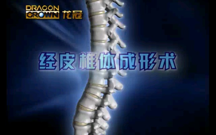 冠龙PVP椎体成形