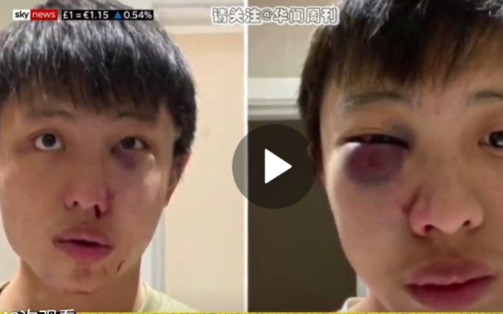 英国因疫情歧视亚裔行为持续增长,对比同期增长近三倍。