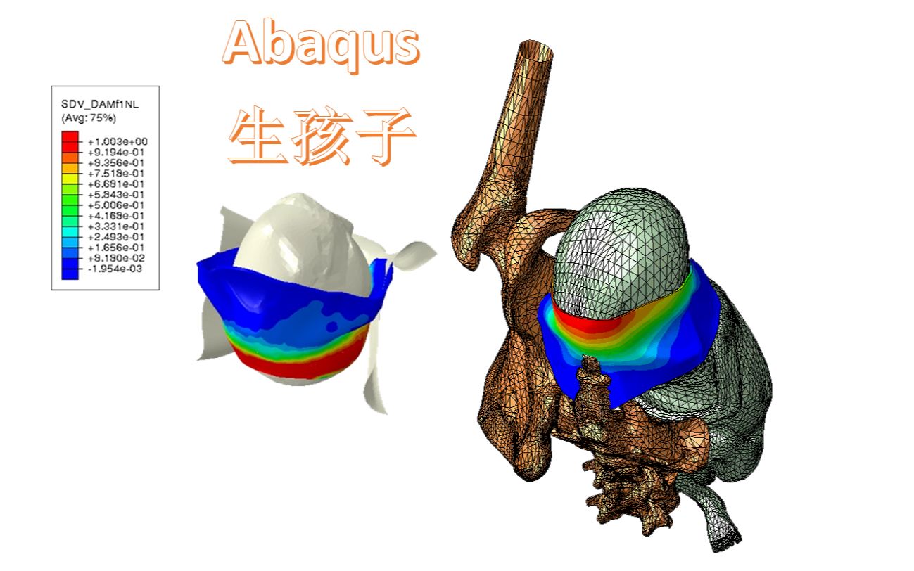 Abaqus生孩子