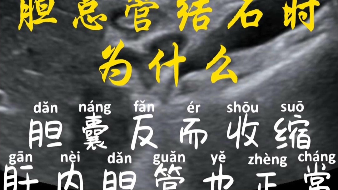 胆总管结石