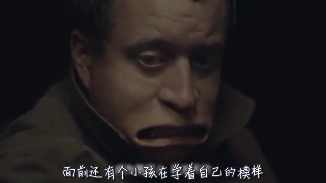 女孩的头上长出了苹果树,还能开花结果,只因小时候吃进了种子