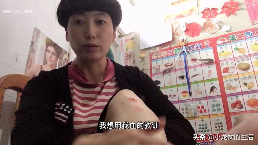 我用血的教训告诉大家,一定要注意交通安全