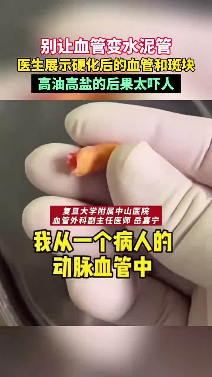 别让血管变水泥管!医生展示硬化后的血管和斑块